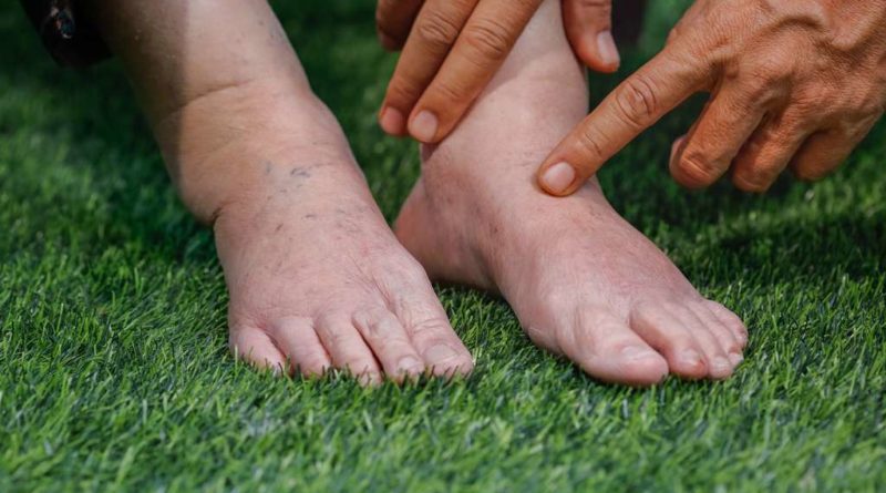 Stawy Charcota – czym jest to schorzenie i jakie są jego przyczyny ...